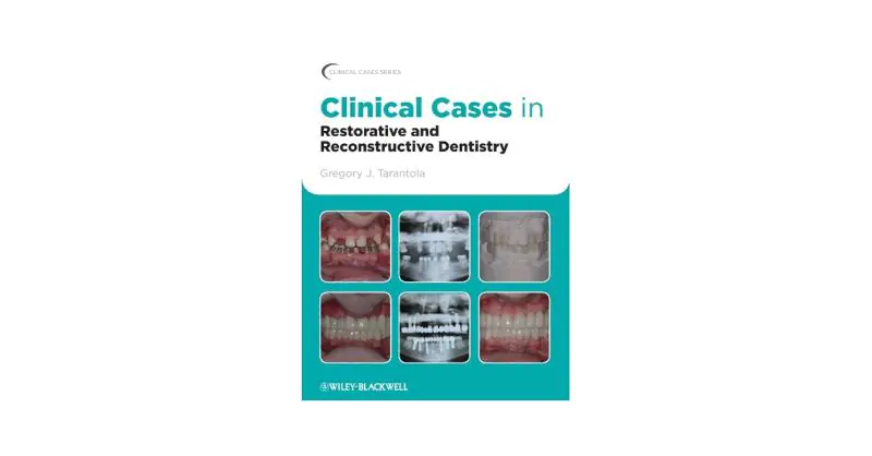 Clinical Cases In Restorative And Reconstructive Dentistry | Toothpick ...